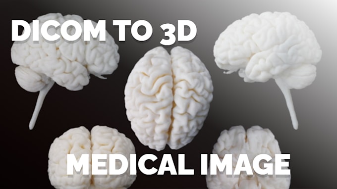 Create a 3d model from your ct or mri dicom by Vivekgpt | Fiverr