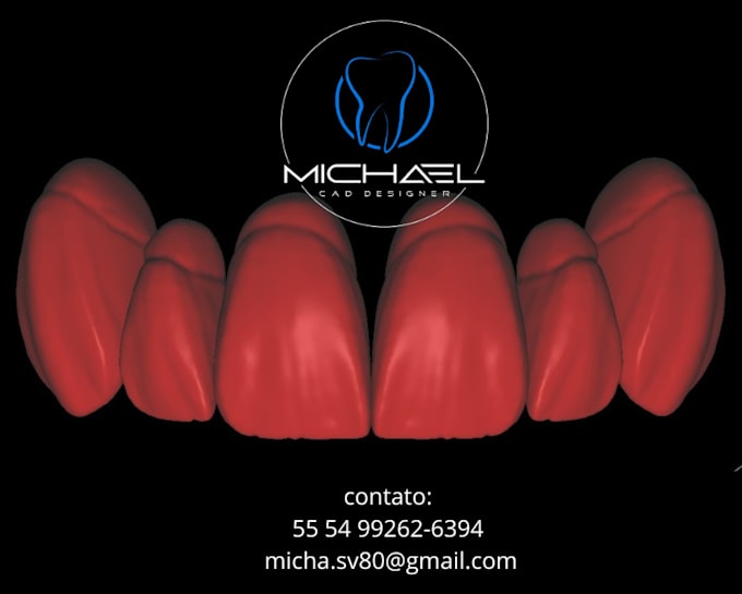 Provide you with top exocad libraries by Raluca_vulcu | Fiverr