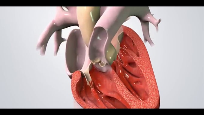 Create 3d medical animation 3d surgery 3d medical video 3d medical ...