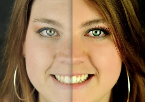 Give You Flawless Skin And Do Other Edits To Your Picture By