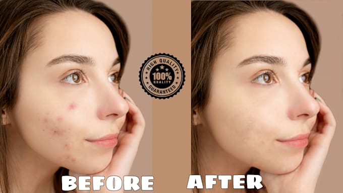 Photoshop photo retouching, pimple remove , skin retouching by Bronexbo ...