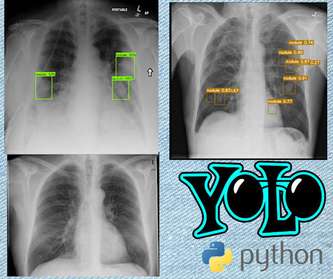 Do medical imaging disease diagnosis in machine learning python by Umairalam77 | Fiverr