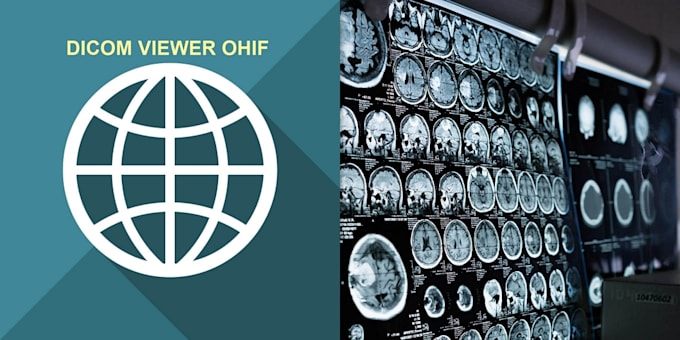Setup ohif dicom viewer for medical imaging by Khizarawan47 | Fiverr