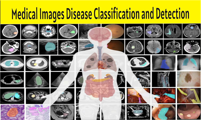 Do Medical Image Classification And Detection In Deep Learning By Adnan Hd Fiverr