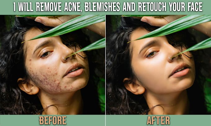 Do skin retouching using photoshop, removing acne by Creative_dice | Fiverr