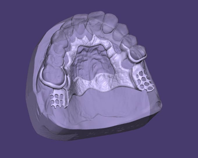 Partial metal framework design in exocad by Laurentiu_nita | Fiverr