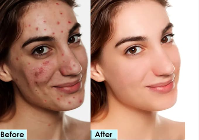 Remove object from photo by photoshop editing professionally by ...