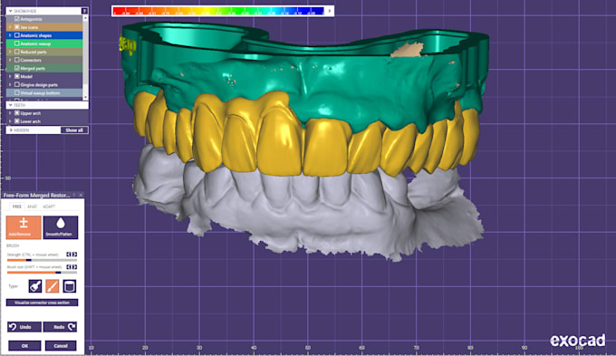 Design crowns,bridges, implants,models, using exocad by Albashik3s | Fiverr