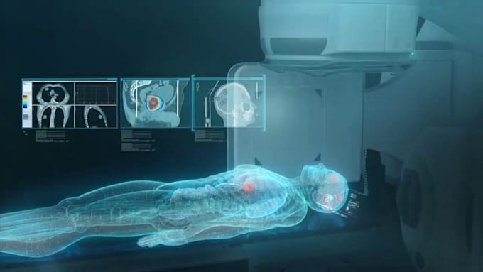 3d medical animation video, medical device anatomy surgery animation ...