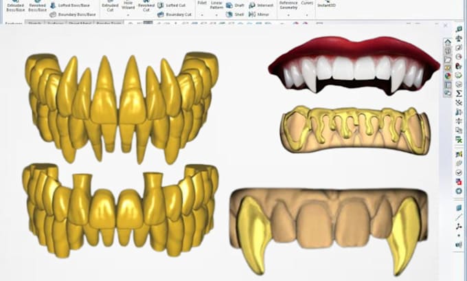 Do solid gold grills and exocad teeth set libraries from 3d scan in ...