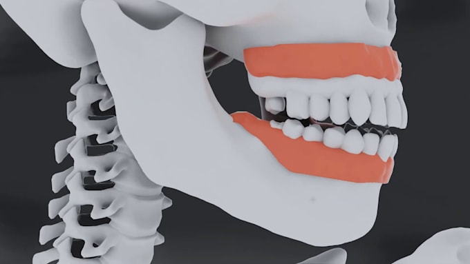 Create 3d medical animation dental implant procedure biotech surgical ...
