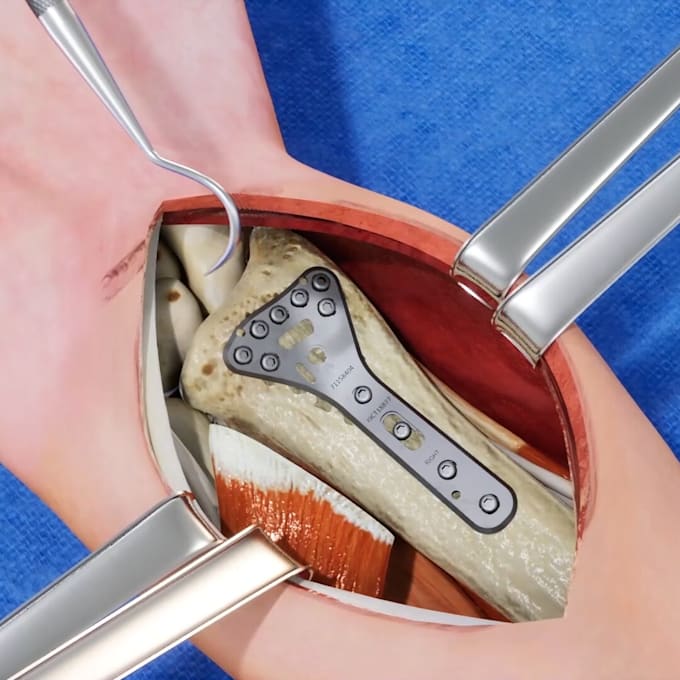 2d 3d medical animation video 3d surgery animation 3d anatomy motion ...