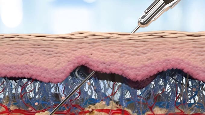 Create high quality 3d medical device animation for healthcare ...