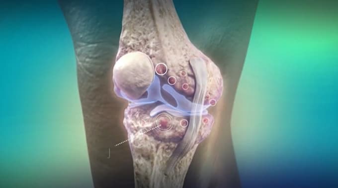 Create 3d medical animation biomedical surgery animation 3d scientific ...