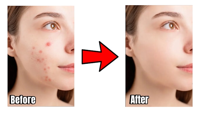 Retouch your skin, remove your pimples in photoshop by Nadee_studio ...