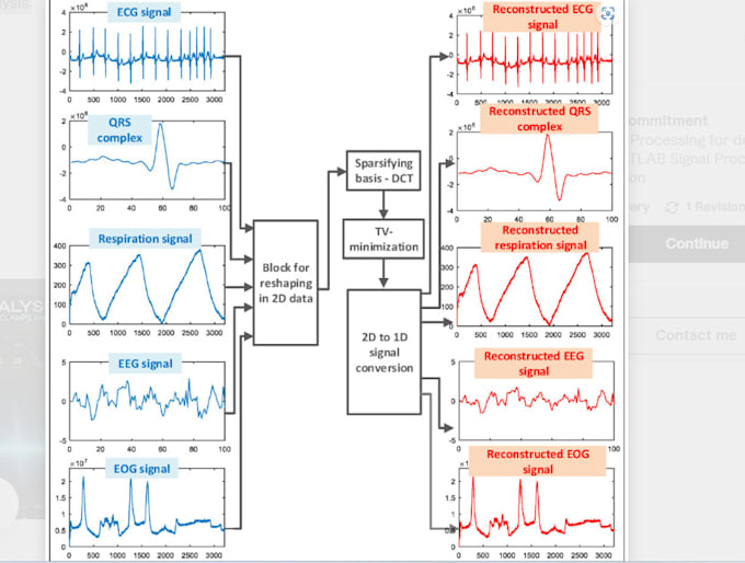 Do biomedical and audio signal processing pcg ecg specialist by ...