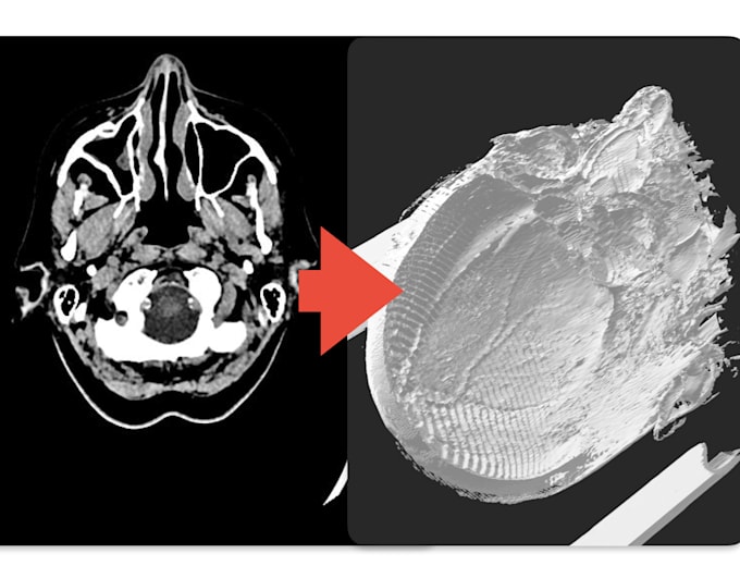 Create 3d models from ct scan images using the marching cubes algorithm ...