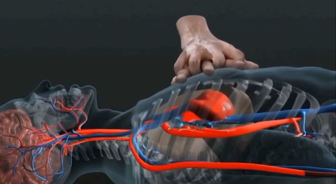 3d medical animation, surgery animations, medical device explainer ...