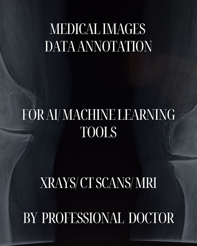 Annotate medical images, xrays, ct mri scans for machine learning ai models by Docmomina | Fiverr