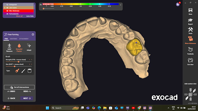 Create custom 3d dental crown designs for your patients by ...