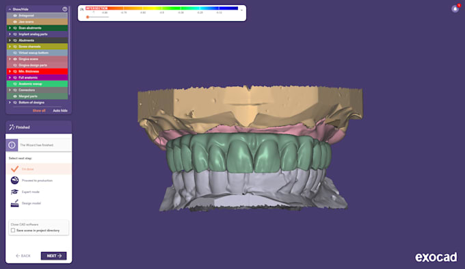 Design snap on smile for 35euro per arch by Marielamana | Fiverr