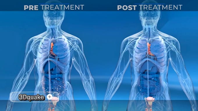 Do 3d medical procedure animation surgical training healthcare ...