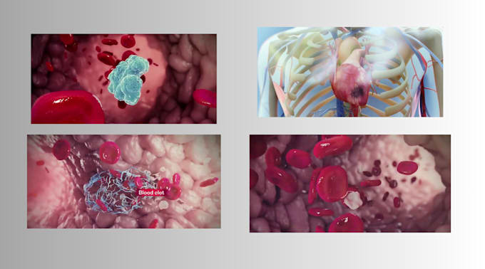 Create quality 3d 2d medical animation, surgical animation, medical ...
