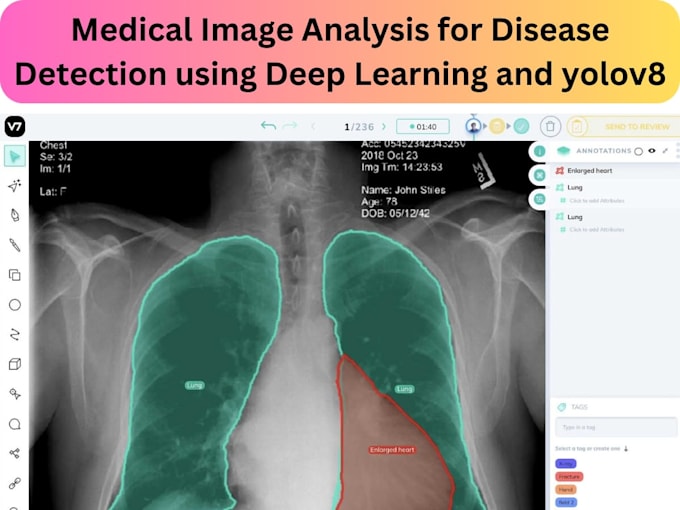Clean, label , train and deploy model for disease detection by Zain_ai_expert | Fiverr