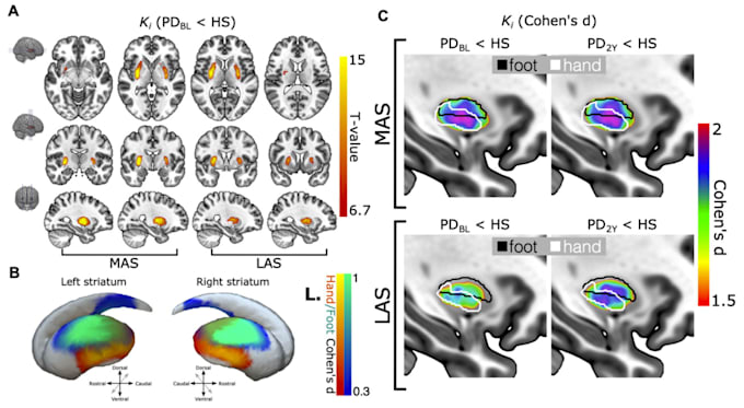Build tailored multimodal neuroimaging pipelines by Josepineda958 | Fiverr