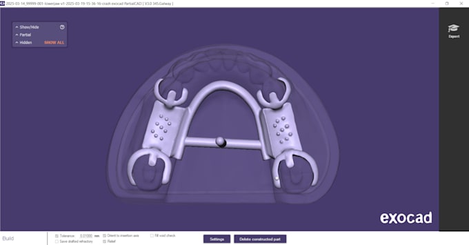 Design high precision vitalium framework for partial denture by ...