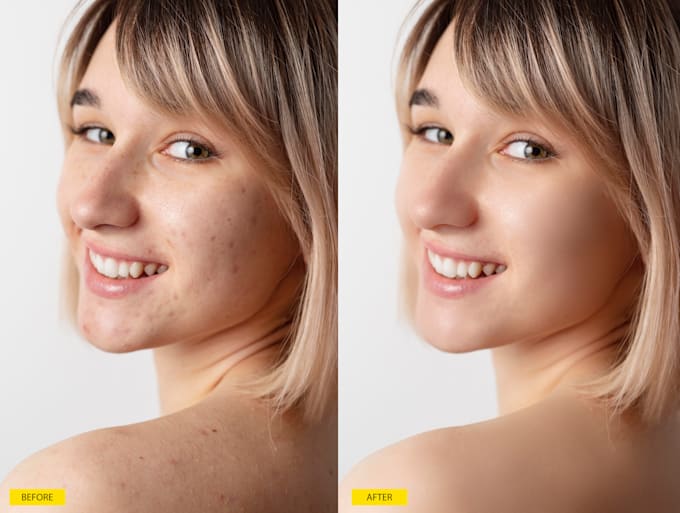 Retouch your skin naturally and remove pimples like a pro by Mithen33 ...