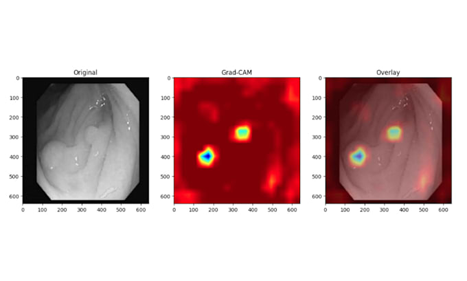 Build ml, dl, nlp, or computer vision models in python with xai support ...