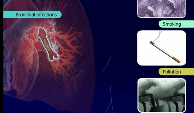 Create eye catching 2d explainer video for medical ,2d and 3d medical ...