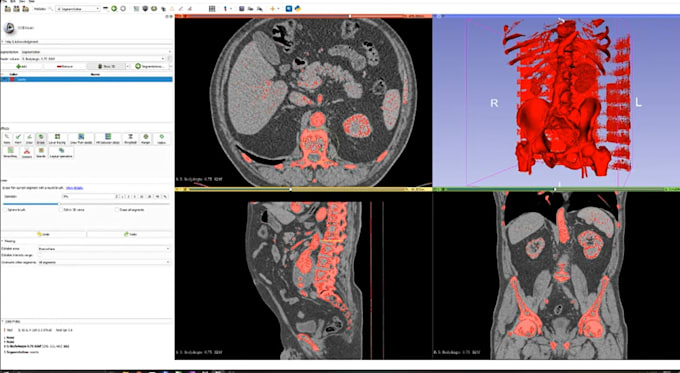 Create 3d printable models from ct or mri dicom files by Senmiles | Fiverr