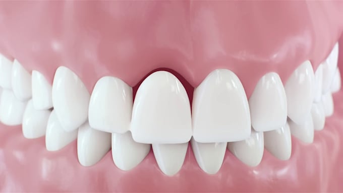 Do 3d orthodontic animation invisalign animation orthodontic treatment ...