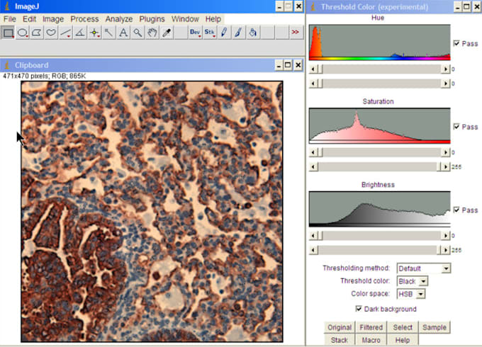 Do imaging analysis using imagej software by Xhordil | Fiverr