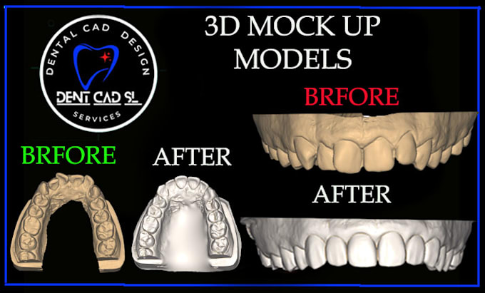 Design smile design, mockup, snap on smile with exocad by Dentcadsl ...