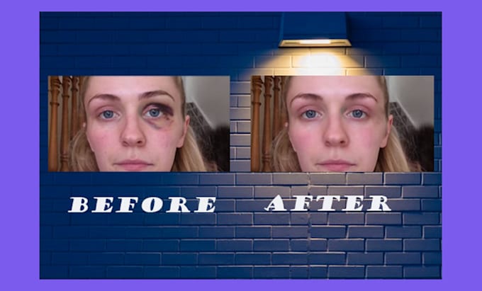 Restore one side damage face and retouching skin by Xevilldevill | Fiverr