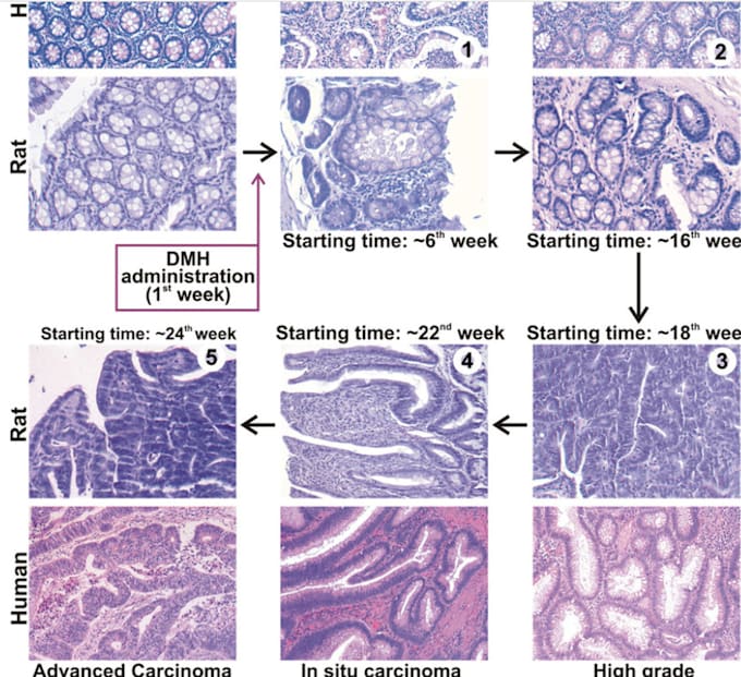 Draw medical diagrams and flow charts for you by hands by ...