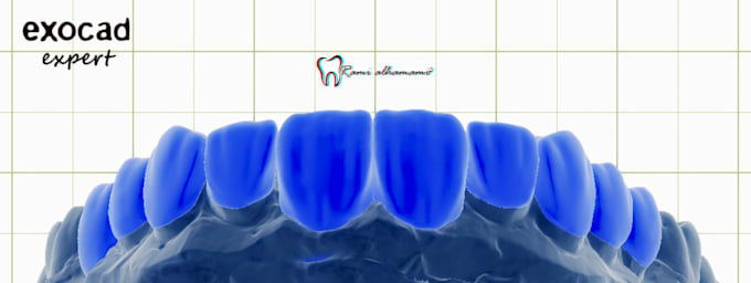 Design dental prosthetist on exocad by Lamolabo | Fiverr