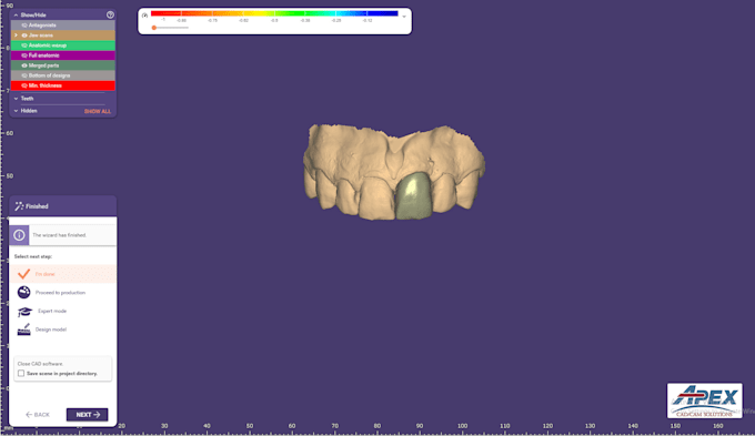 Upgrade your dental smile cases to max level using exocad software by ...