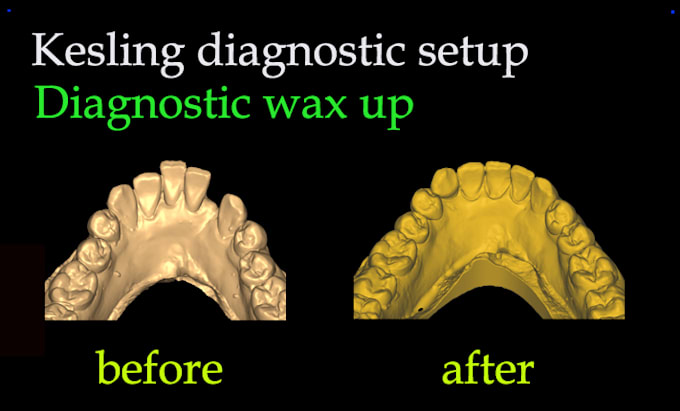 Design kesling diagnostic setup by Dentcadsl | Fiverr