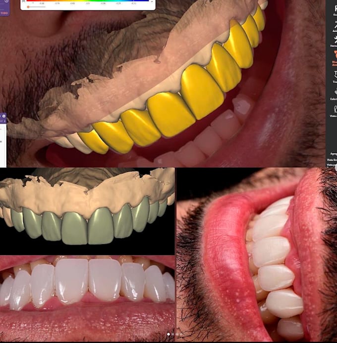 Make a high quality exocad design of dental crown and surgical guides ...