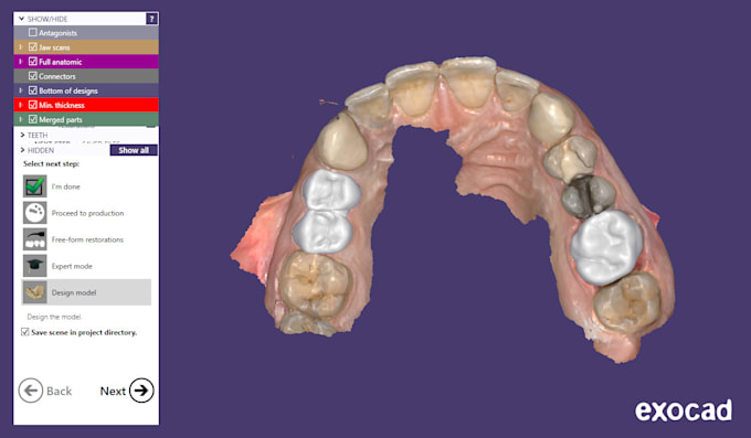 Design crown bridge and dental restorations in exocad by Fadywilliam562 ...