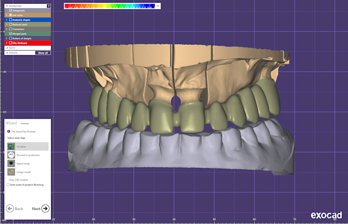 Design in exocad for dental by Emiliaorban98 | Fiverr