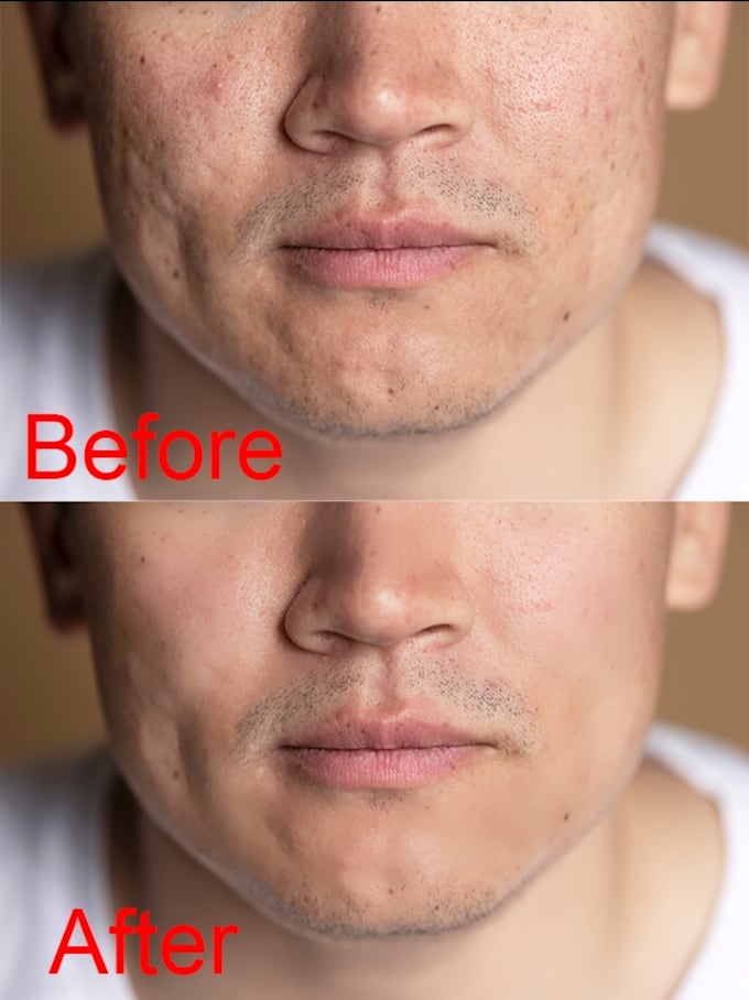 Swap face in the photo with someone else face or retouching image by ...