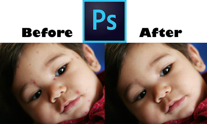 Do photo retouching remove pimples, wrinkles, acne using photoshop by ...