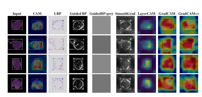 Medical imaging classification expertise by Umair2007pak | Fiverr