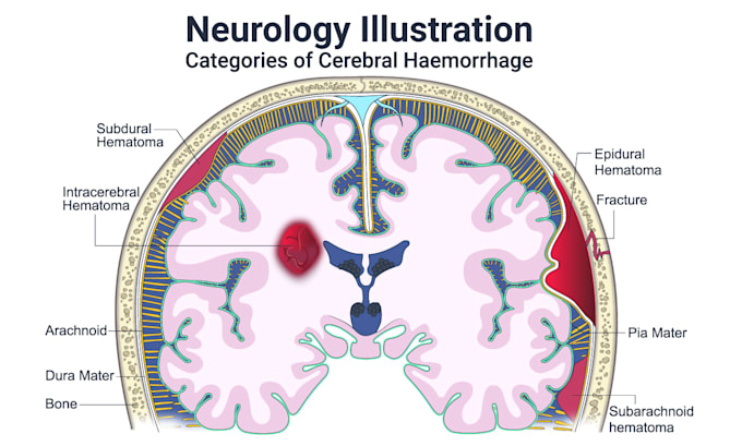Produce graphical abstract, healthcare, medical illustration by Taras12 ...