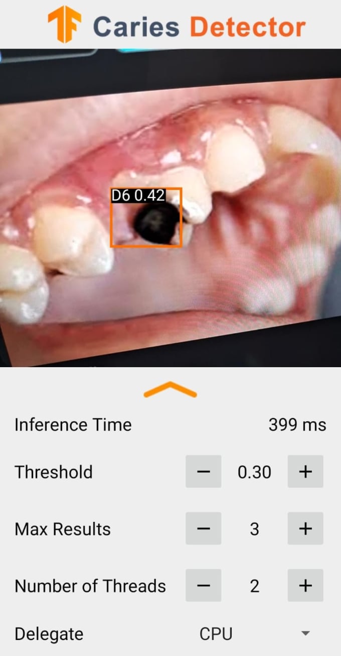 Build A Custom Object Detection Model With Tensorflow Lite By Rizki
